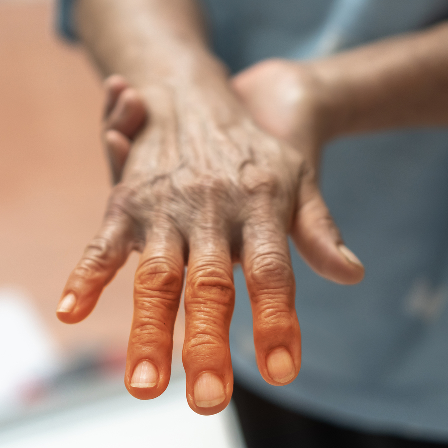 What Is the Root Cause of Numbness and Tingling? | Advanced Spinal Care